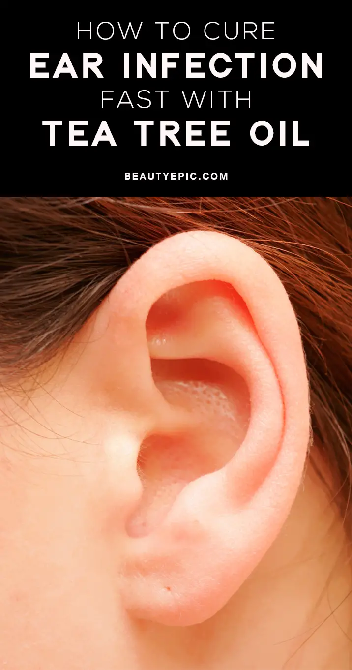 earinfection-千图网