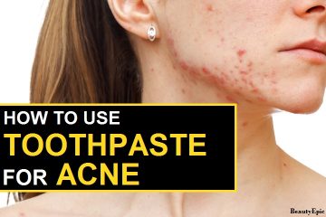 How Does Toothpaste Help With Acne?