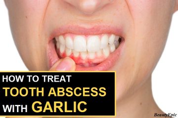 How To Use Garlic For Tooth Abscess?