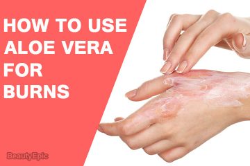 How To Use Aloe Vera For Burns?