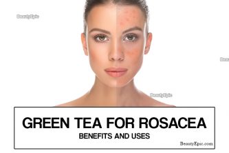 How To Use Green Tea For Rosacea