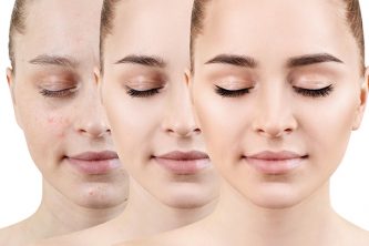 How To Determine Your Skin Tone?