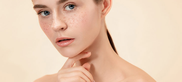 How to Tan with Fair Skin and Freckles?